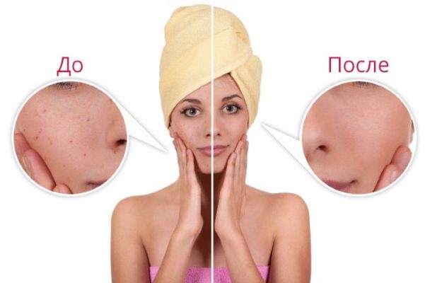 Atraumatic face cleansing. What is it, reviews, before and after photos